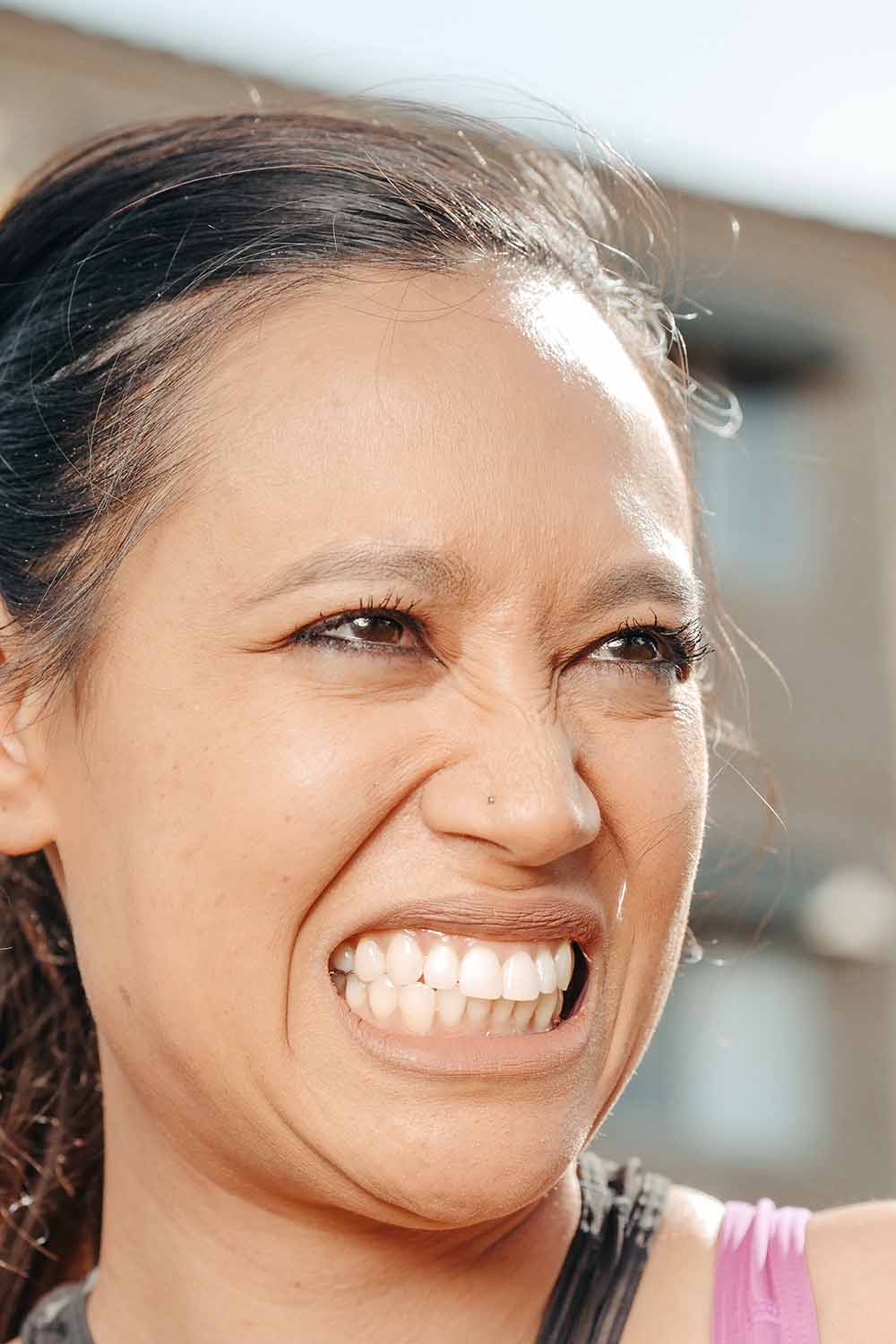 Bruxism: Causes and Symptoms | Hollymead Dental Arts